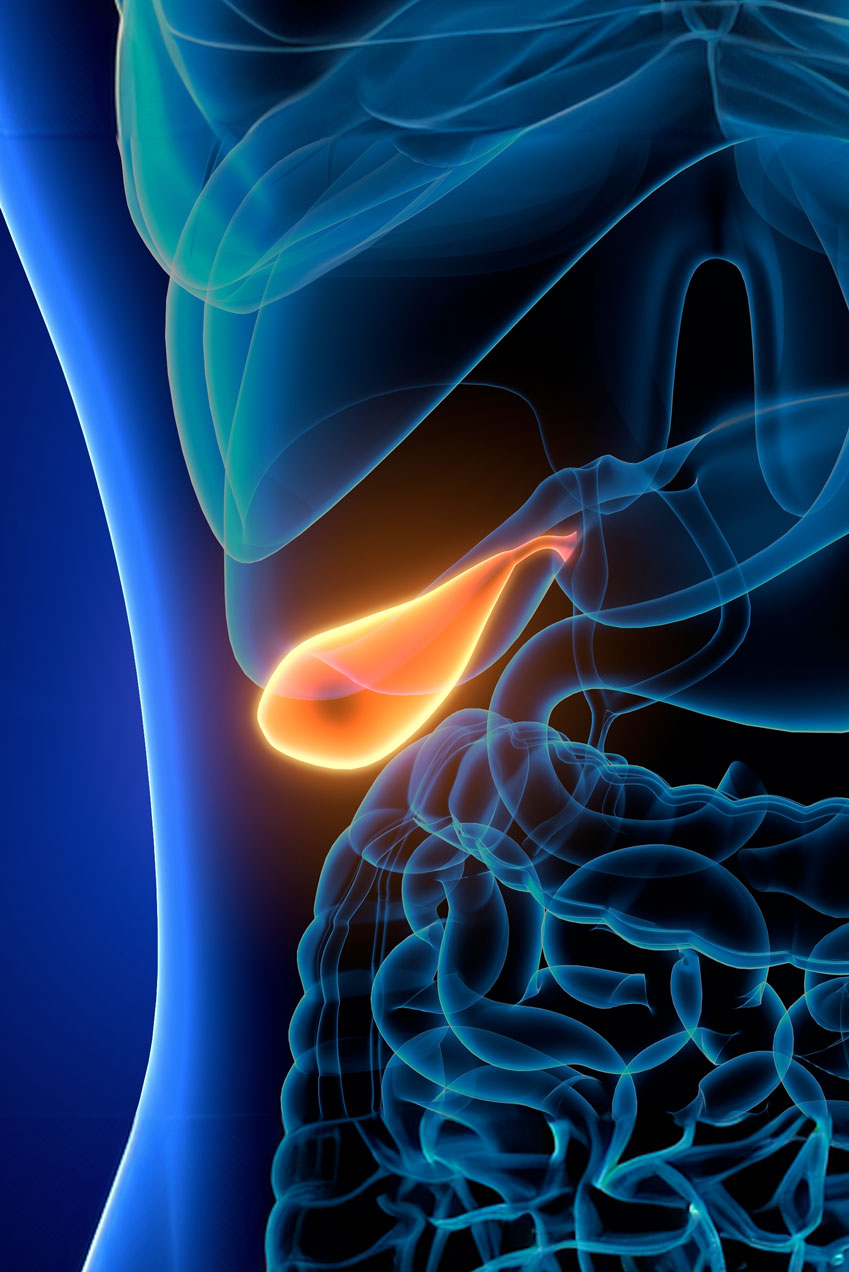 Cálculos da Vesícula Biliar - Vídeo - Leandro Bellina